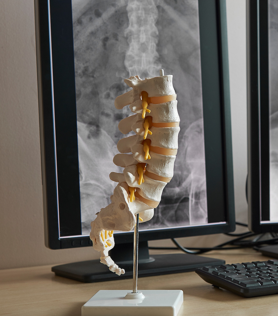 Pain Treatment Options – Advanced Disc Replacement